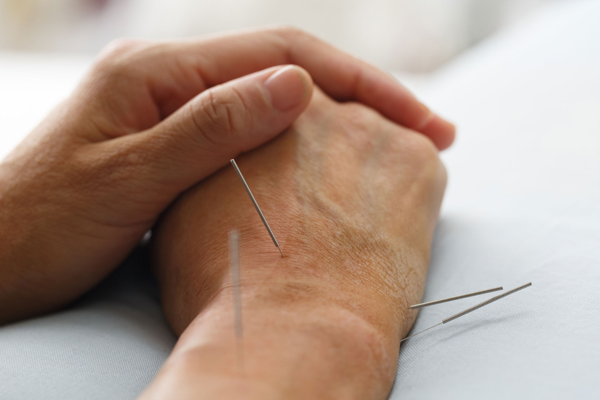 Chronic Inflammation Hands Acupuncture with Flying Needle Medicine